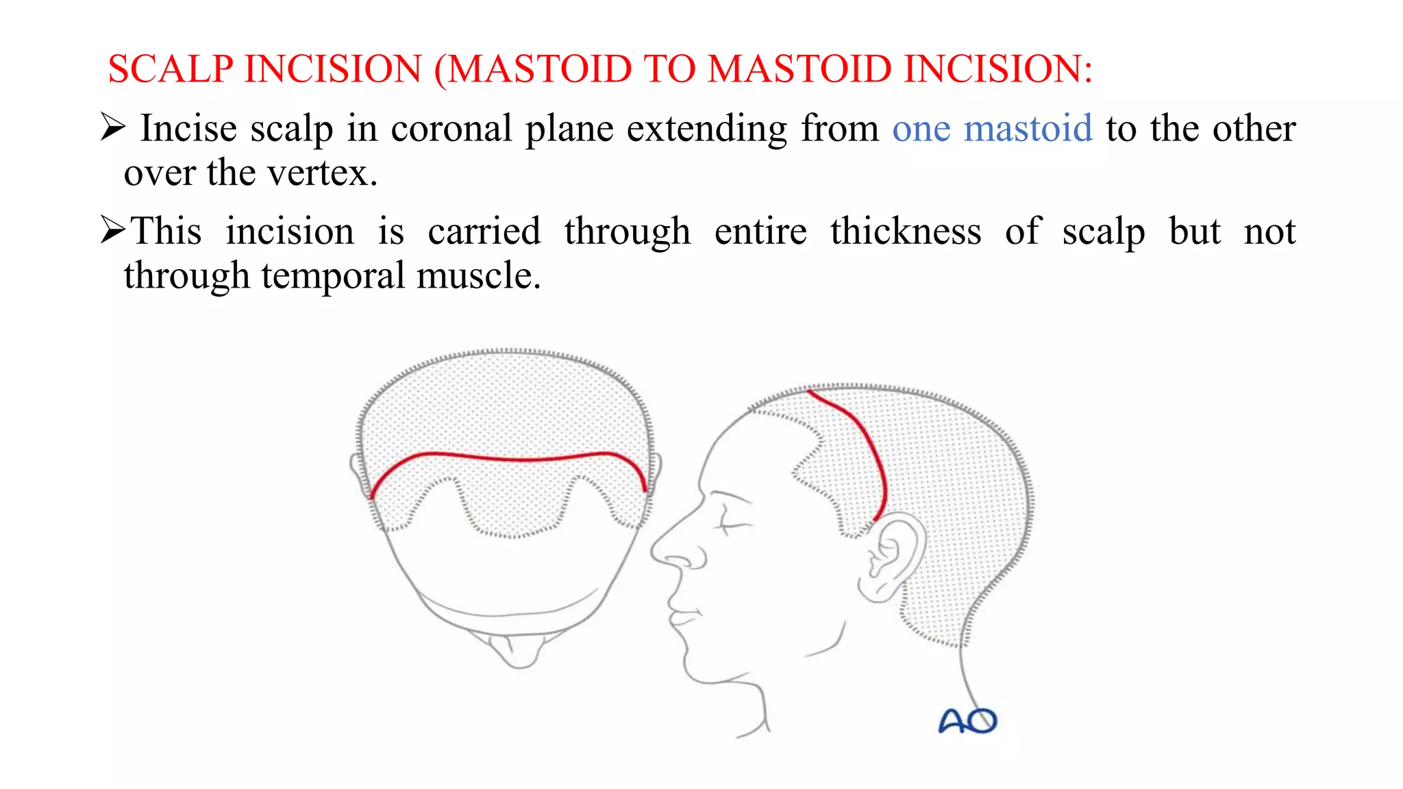 Presentation autopsy incisions-.pptx. Dr. Haricharan MD RIMS Imphal ...
