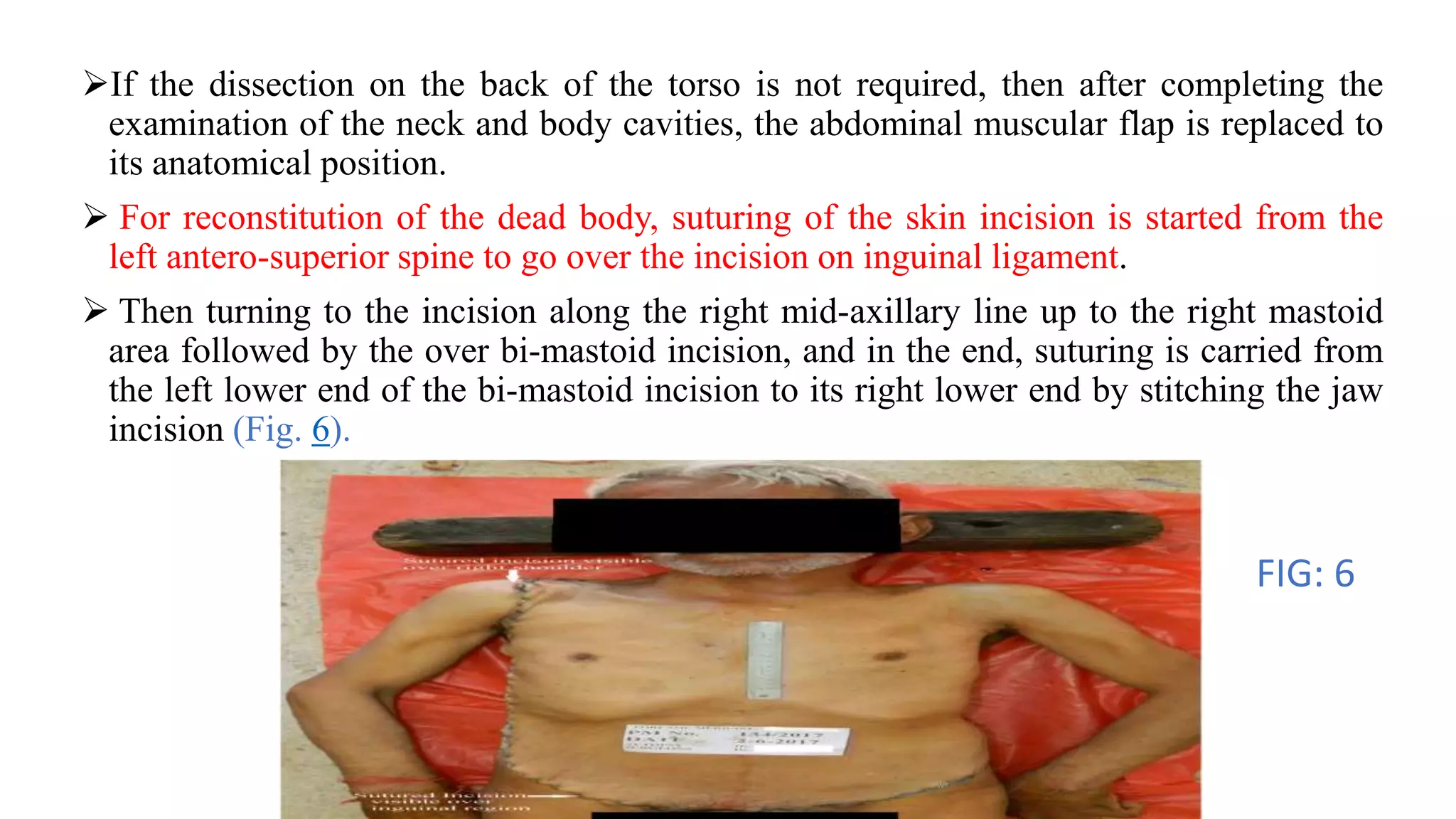 Presentation autopsy incisions-.pptx. Dr. Haricharan MD RIMS Imphal ...