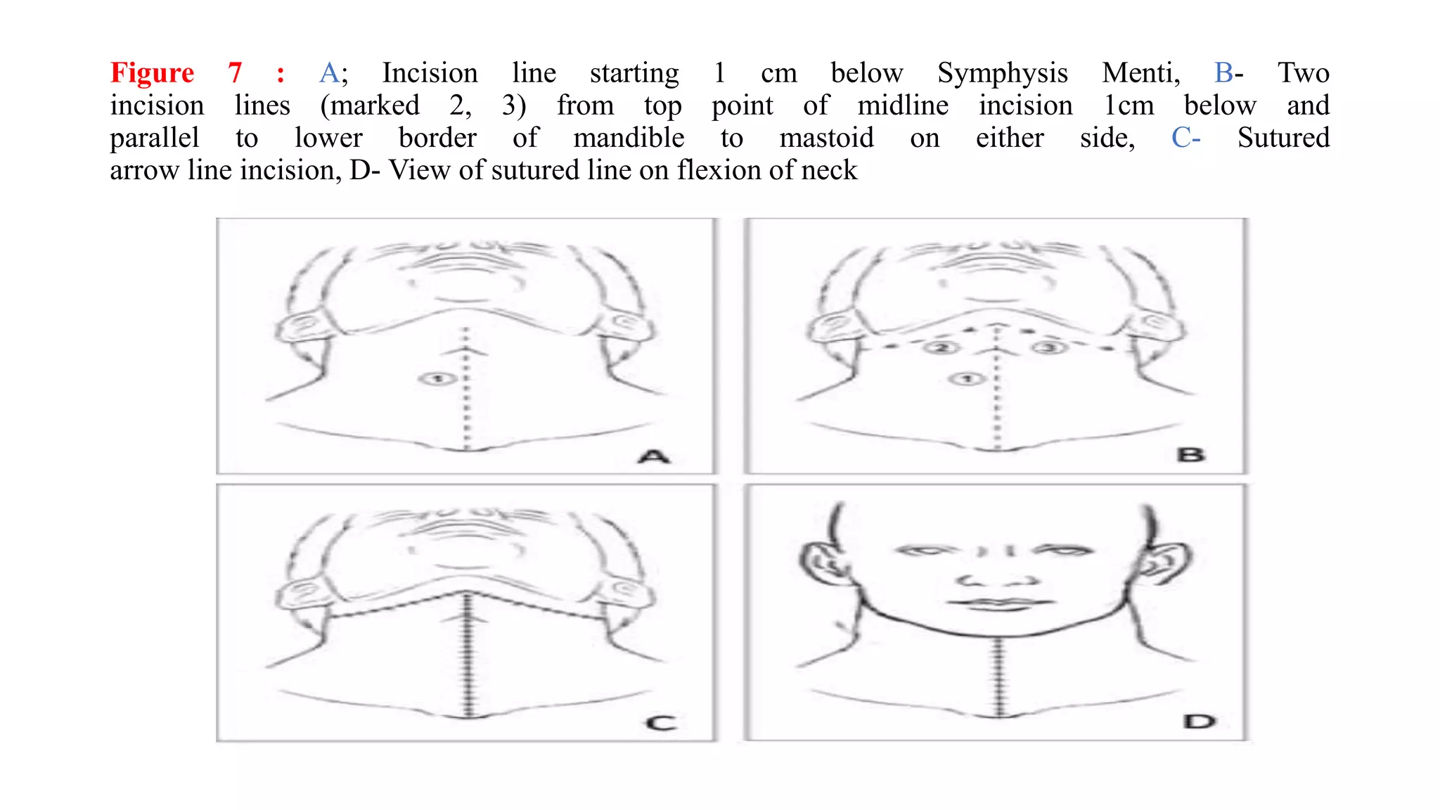 Presentation autopsy incisions-.pptx. Dr. Haricharan MD RIMS Imphal ...