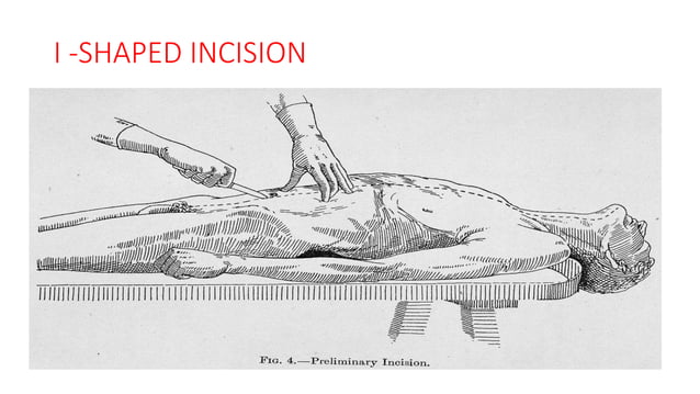 Presentation autopsy incisions-.pptx. Dr. Haricharan MD RIMS Imphal ...