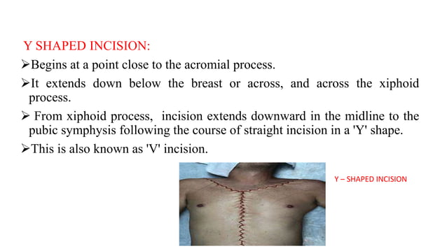 Presentation autopsy incisions-.pptx. Dr. Haricharan MD RIMS Imphal ...