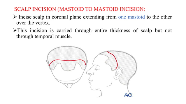 Presentation autopsy incisions-.pptx. Dr. Haricharan MD RIMS Imphal ...