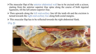 Presentation autopsy incisions-.pptx. Dr. Haricharan MD RIMS Imphal ...