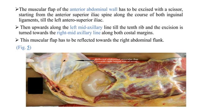 Presentation autopsy incisions-.pptx. Dr. Haricharan MD RIMS Imphal ...