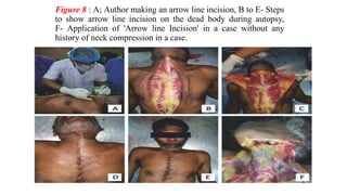 Presentation autopsy incisions-.pptx. Dr. Haricharan MD RIMS Imphal ...