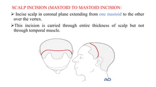 Presentation autopsy incisions-.pptx. Dr. Haricharan MD RIMS Imphal ...