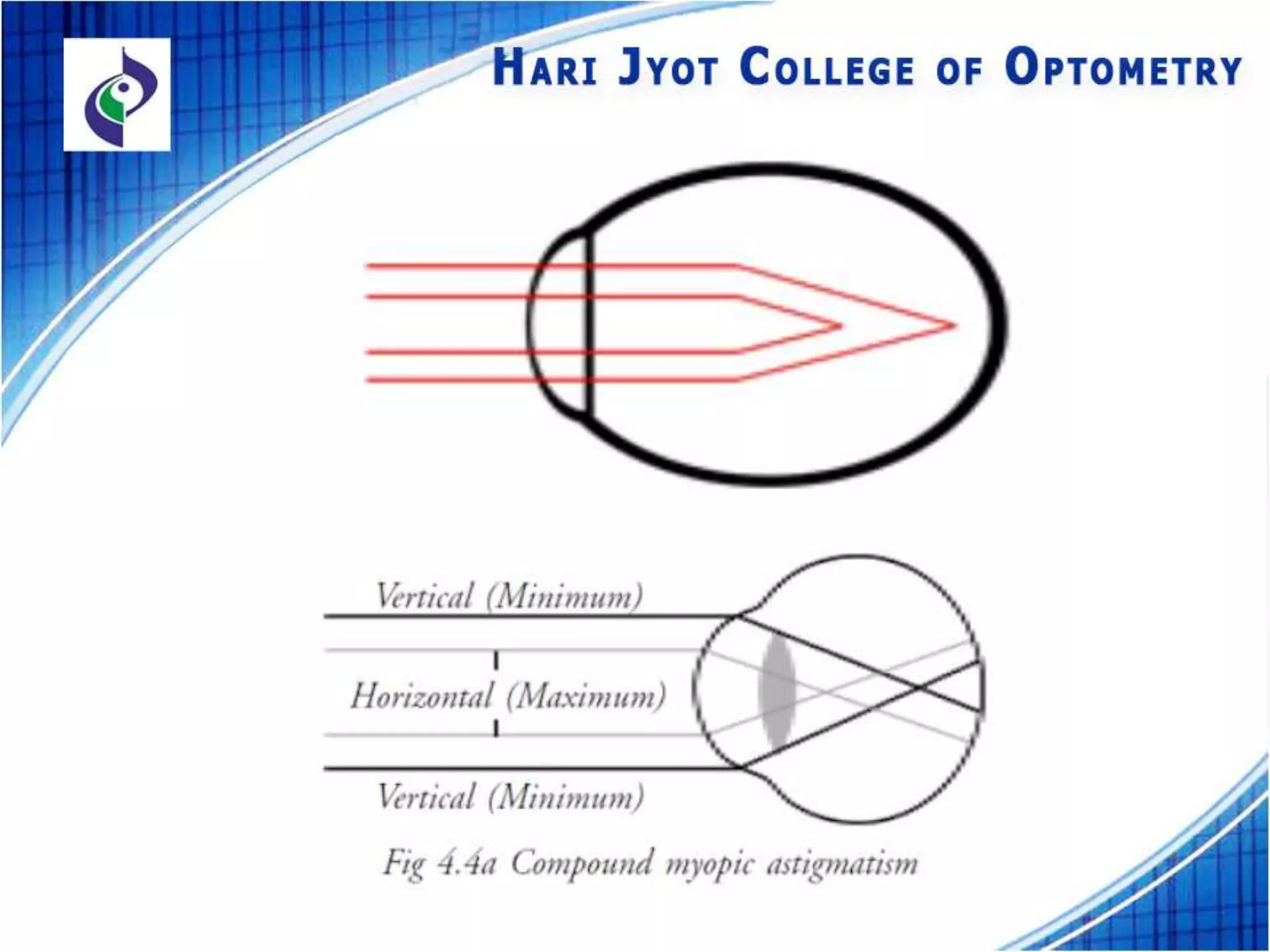 Astigmatic fan | PPTX