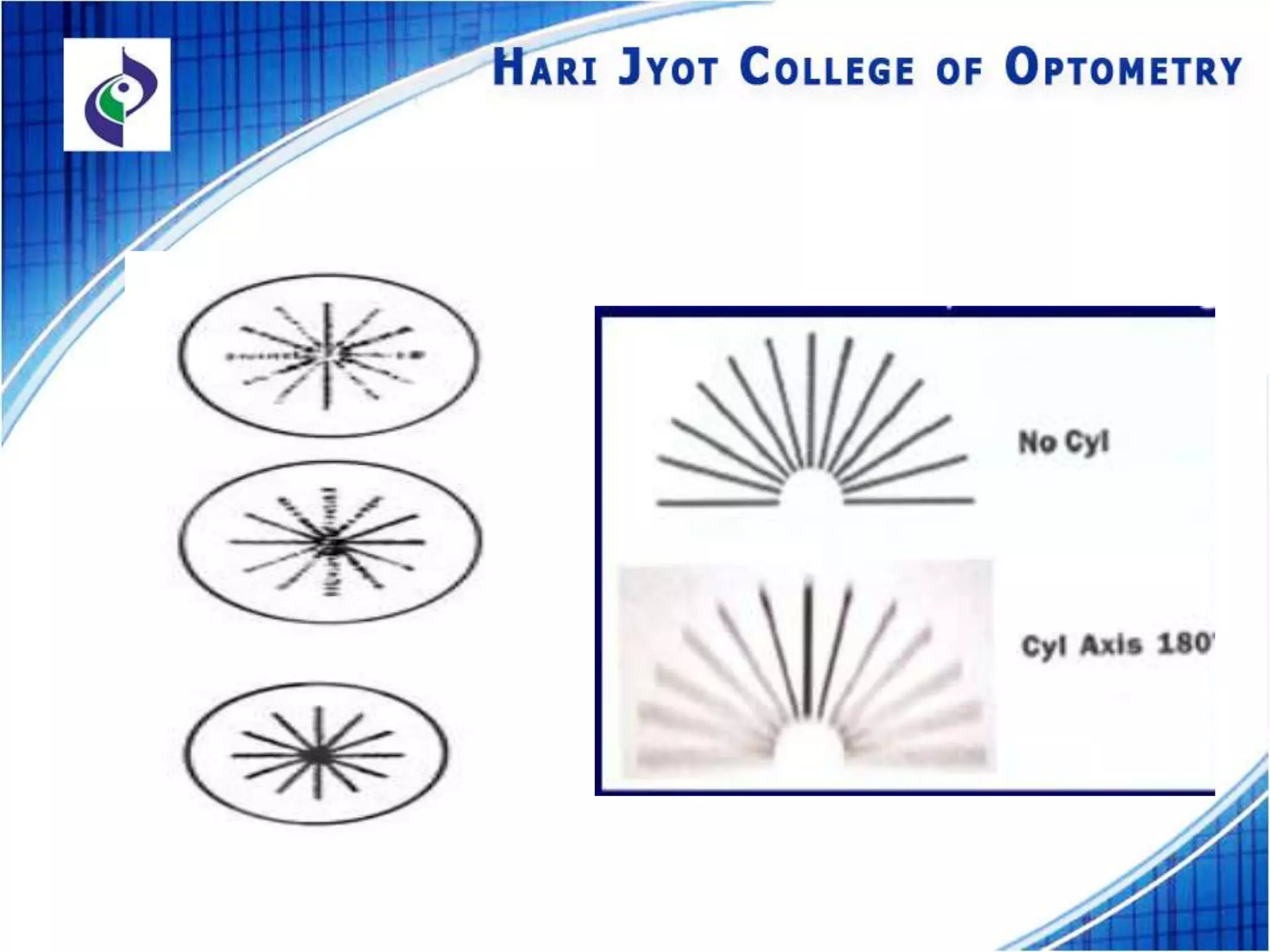Astigmatic fan | PPTX