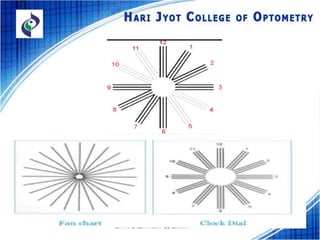 Astigmatic fan | PPTX