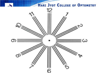 Astigmatic fan | PPTX