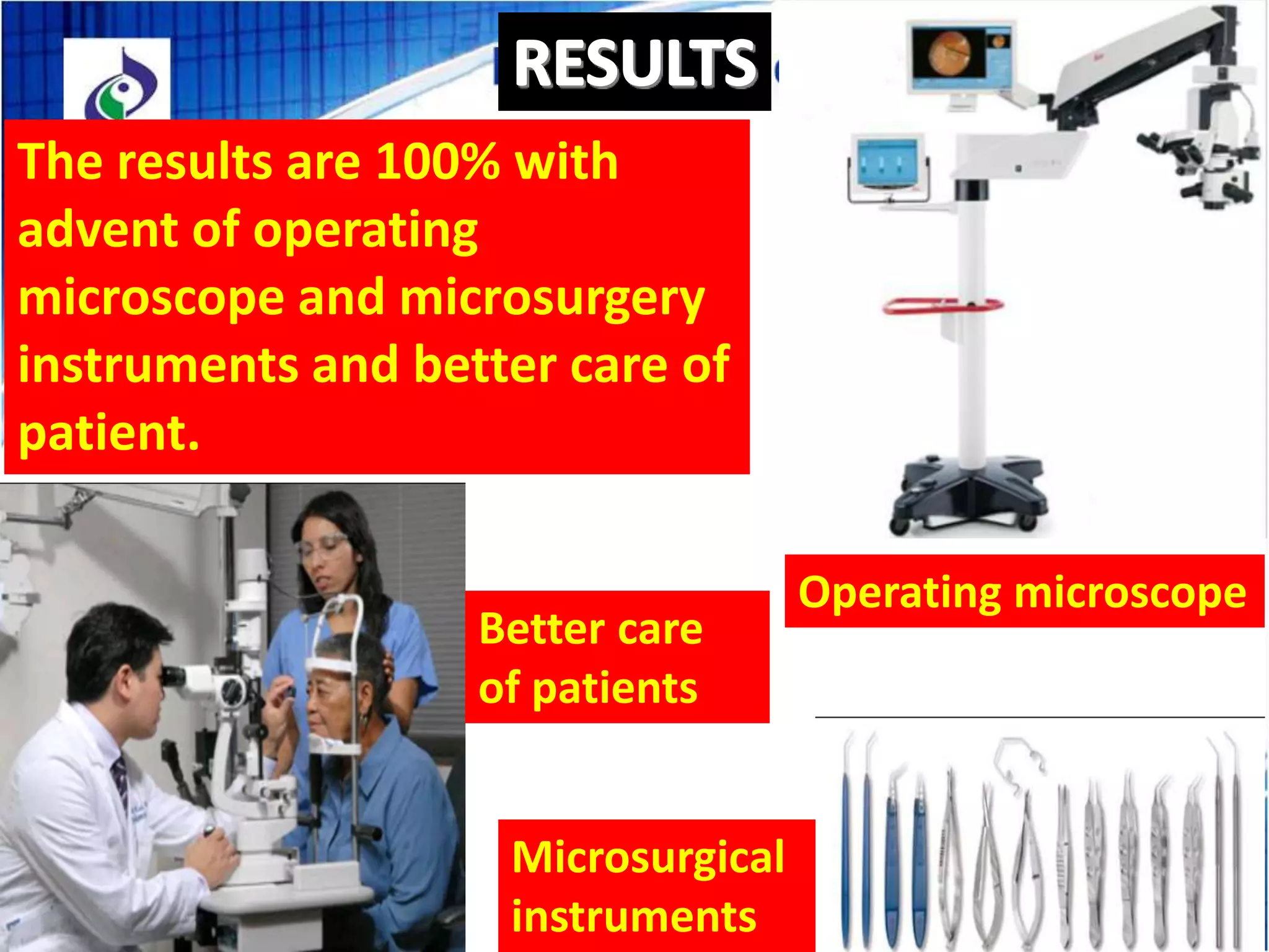Intracapsular Cataract extraction | PPTX