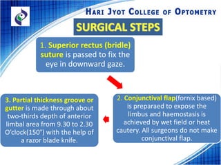 Intracapsular Cataract extraction | PPTX