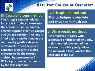 Intracapsular Cataract extraction | PPTX