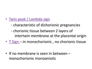 Multiple Pregnancy - Diagnosis ,Clinical Features & Complications | PPTX