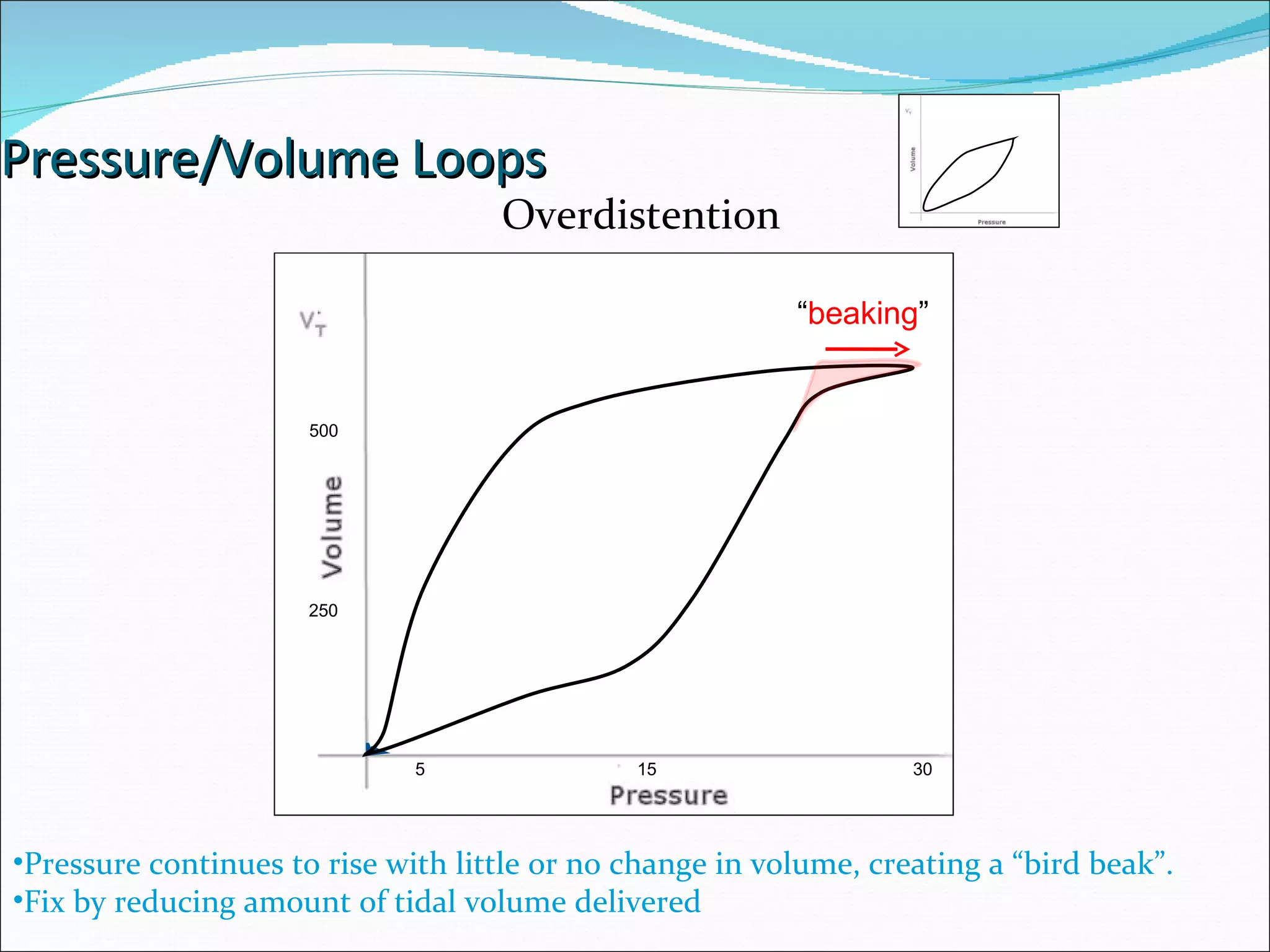 Ventilator Graphics | PPT