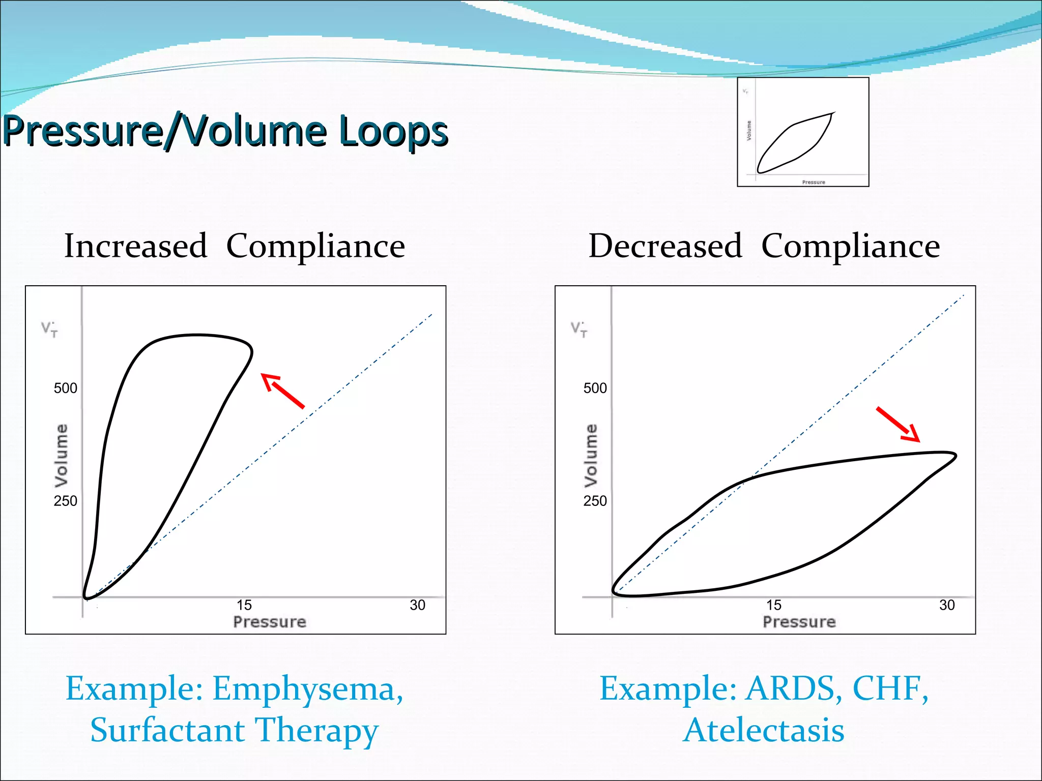 Ventilator Graphics | PPT