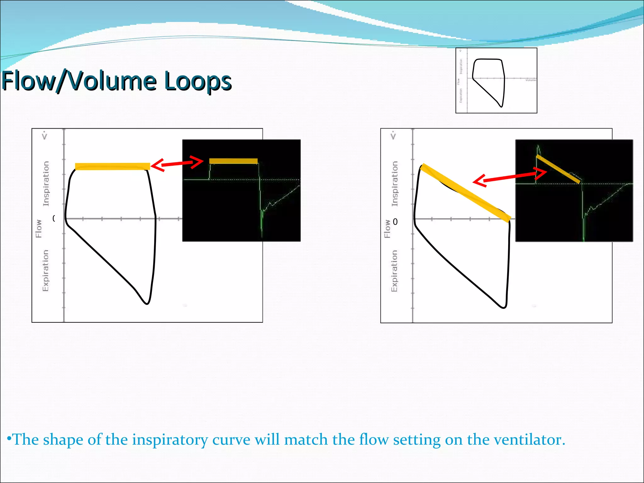 Ventilator Graphics | PPT