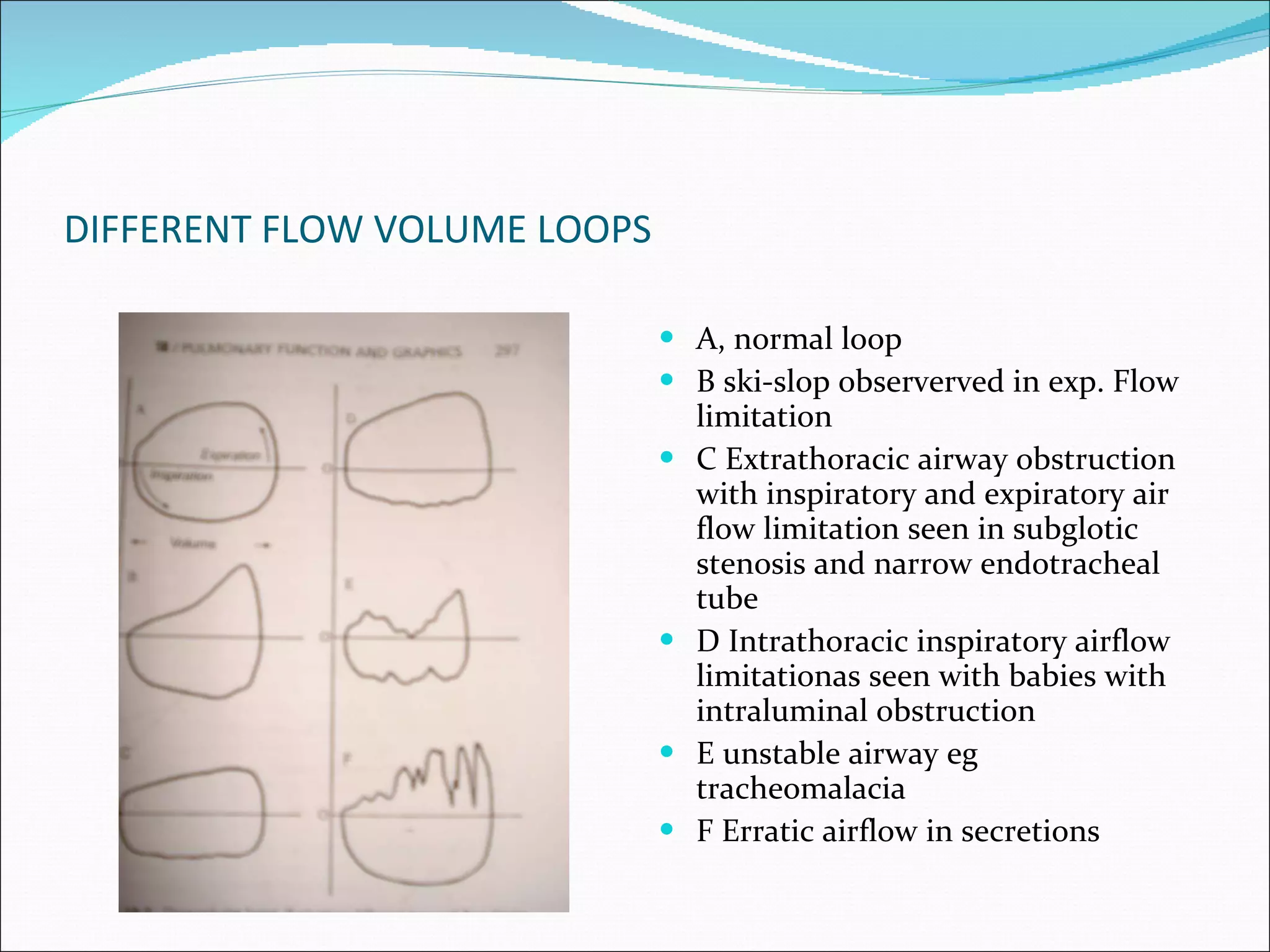 Ventilator Graphics | PPT
