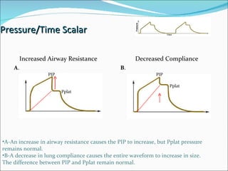 Ventilator Graphics | PPT