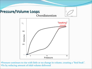 Ventilator Graphics | PPT