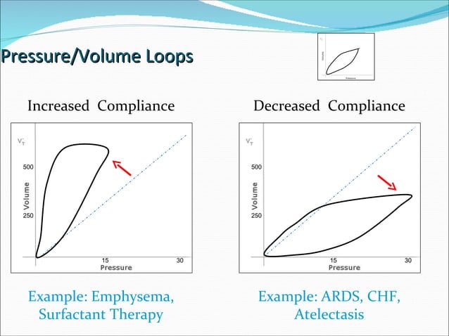 Ventilator Graphics | PPT | Lung and Respiratory Health | Diseases and ...