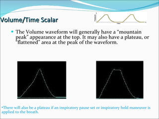 Ventilator Graphics Made Easy