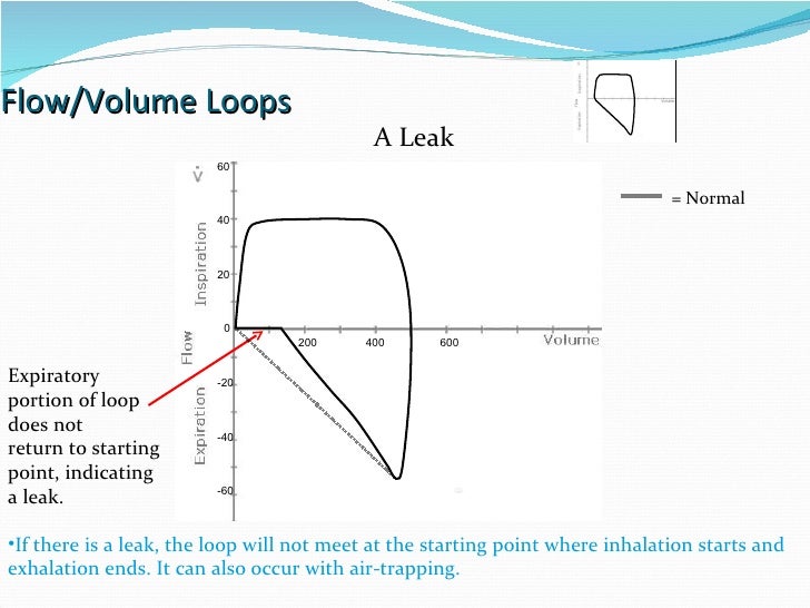 Ventilator Graphics