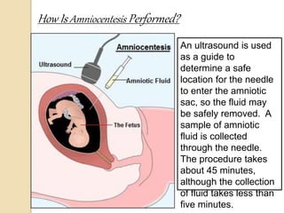 PRENATAL DIAGONOSIS OF GENETIC DISORDERS | PPTX