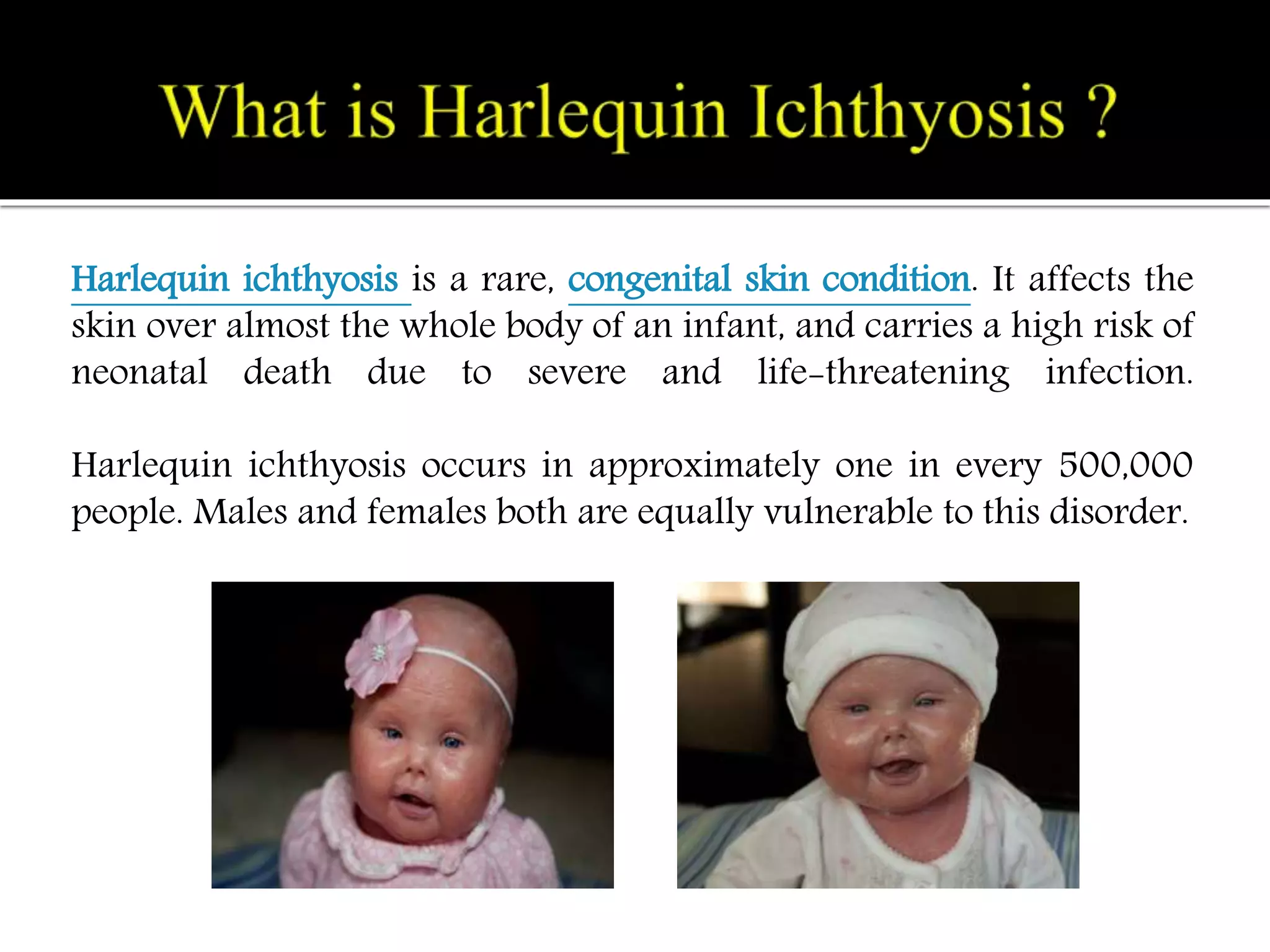 Harlequin Ichthyosis: Causes, symptoms, complications and treatment. | PPTX