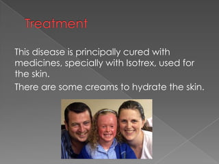 Harlequin syndrome | PPTX