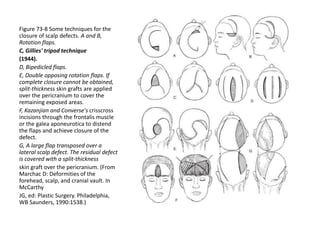 Harold gillies | PPT