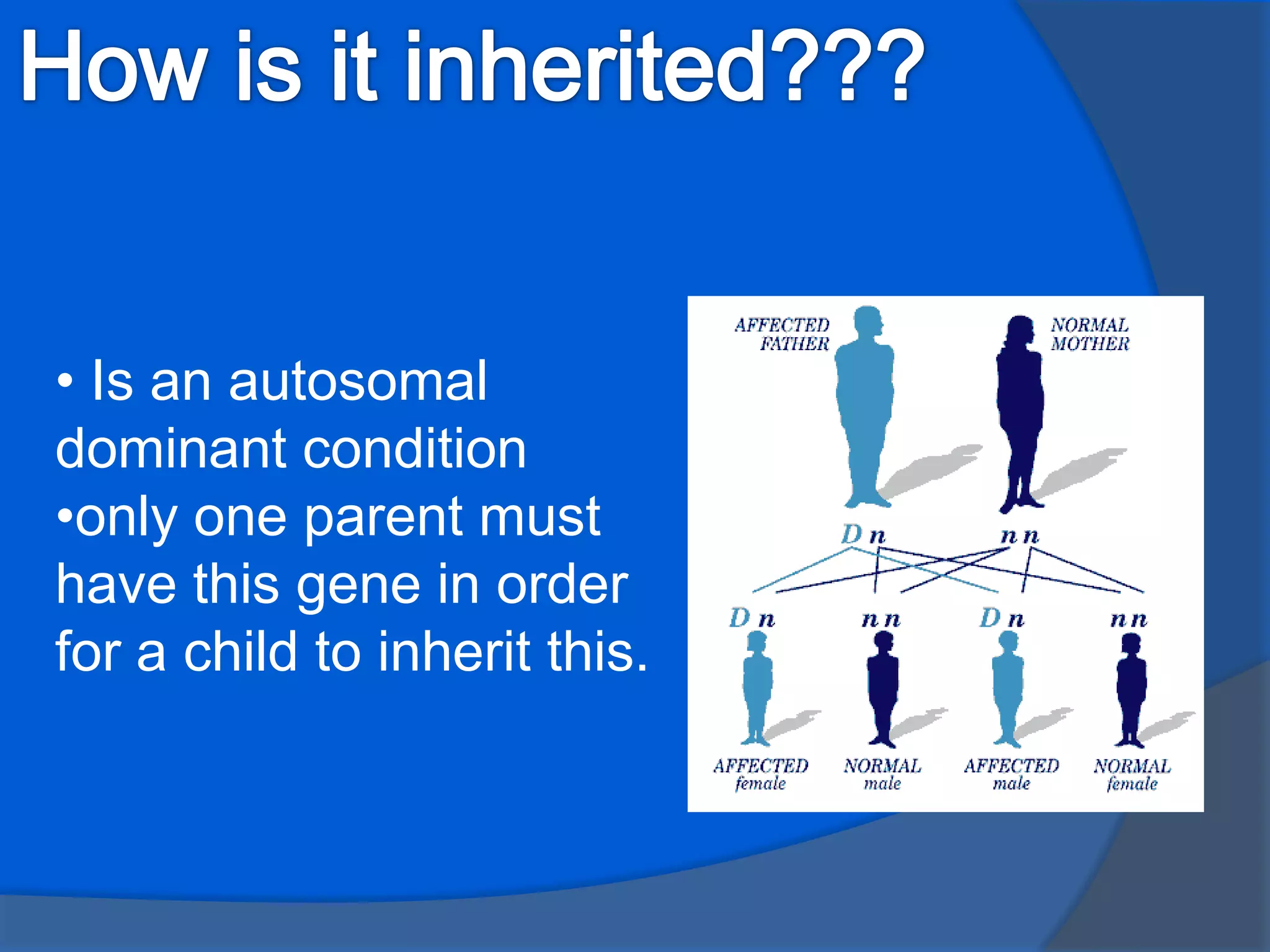 Huntington's Disease | PPTX