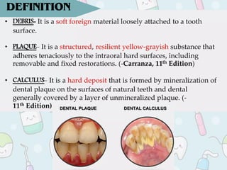 Oral hygiene index simplified pptttttpdf | PPT
