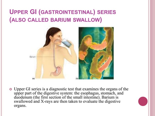 Anatomy and physiology of GI system and Diagnostic techniques | PPT
