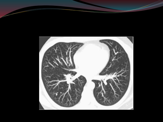 DR Harshil Radiology HRCT | PPT