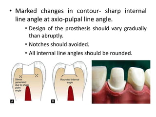 Mechanical Properties of Dental Materials | PPTX