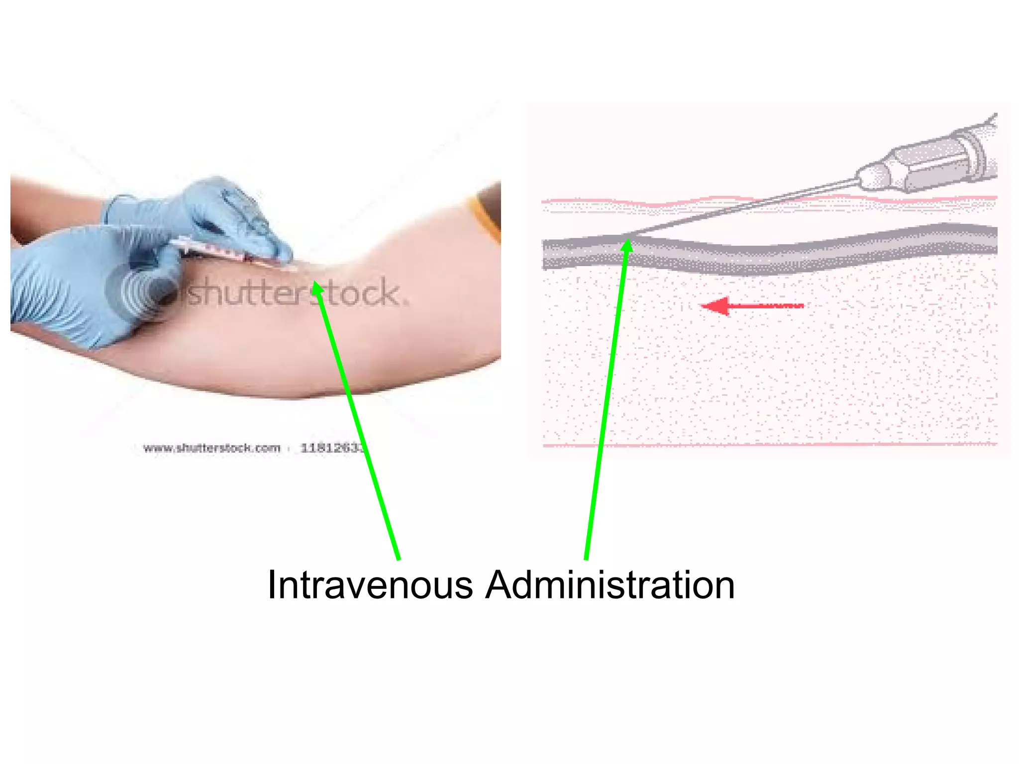 Routes of Drug administration - Pharmacology | PPT