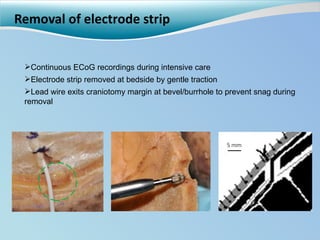 Hartings, Jed - EcoG | PPT