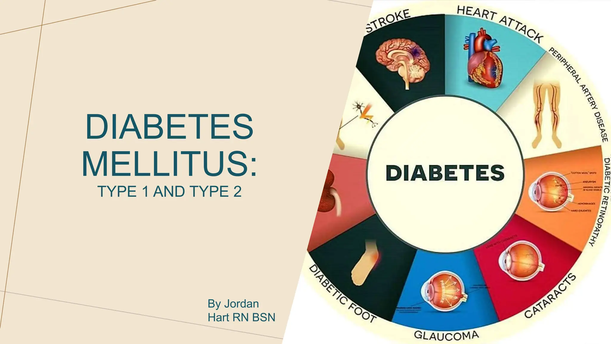 MASTERS (MSN) PRESENTATION FOR DIABETES MELLITUS | PPTX