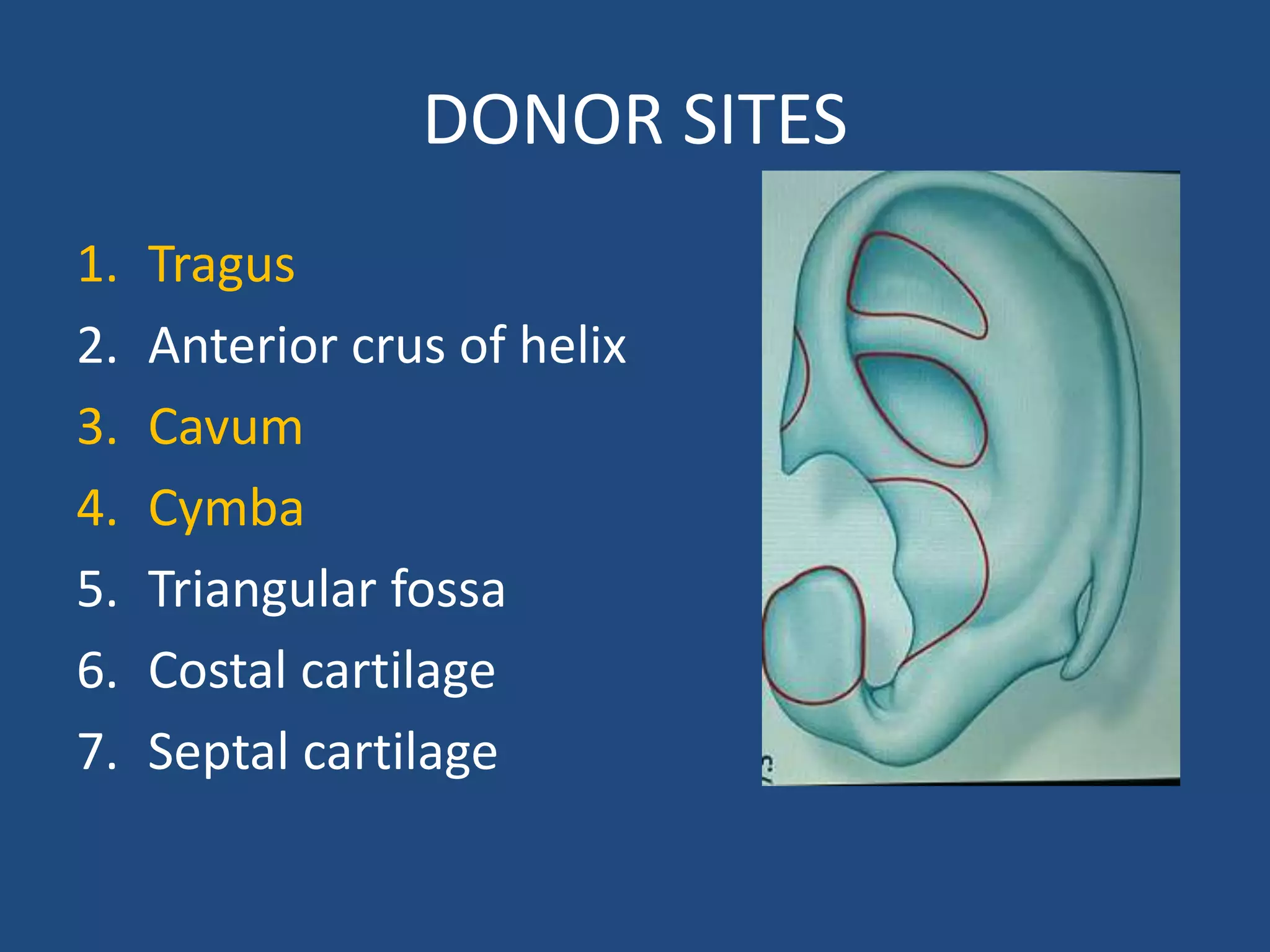 Harvesting cartilage for cartilage tympanoplasty | PPSX