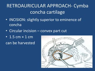 Harvesting cartilage for cartilage tympanoplasty | PPSX | Ear, Nose and ...