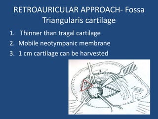 Harvesting cartilage for cartilage tympanoplasty | PPSX | Ear, Nose and ...