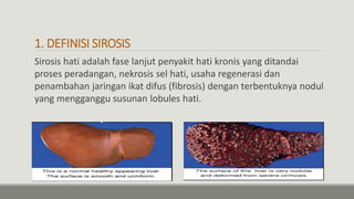 Hasan_Sirosis.pptx
