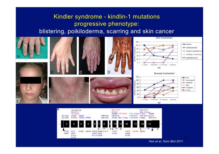 Молекулярная гетерогенность пузырчаток: парадигма буллезного эпидермо…