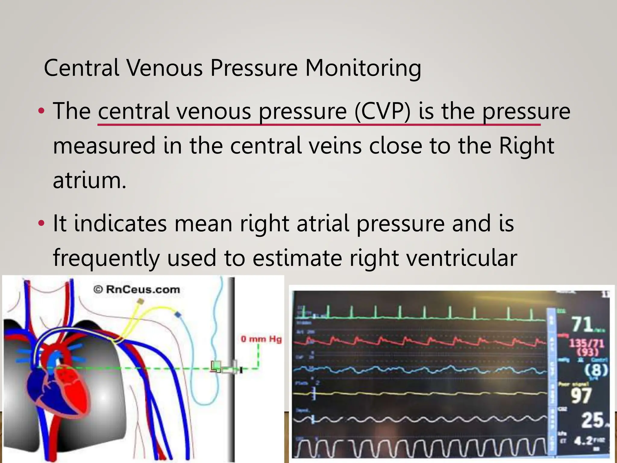 HASEEN central venous catheter and it's monitoring.pptx