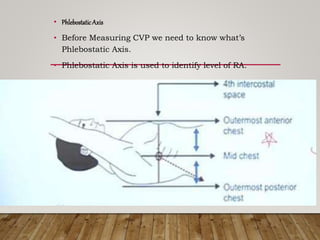 HASEEN central venous catheter and it's monitoring.pptx