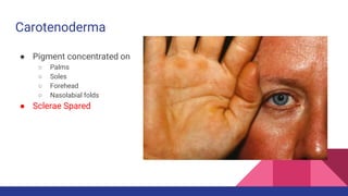 Carotenoderma