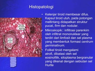 Hashimoto disease | PPTX