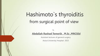 Hashimoto`s thyroiditis.pptx