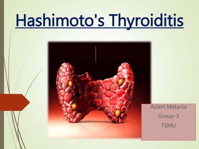 Hashimoto's thyroiditis by aslammatania | PPTX